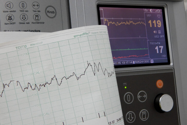 Normal Fetal Heart Rate Ranges And Milestones