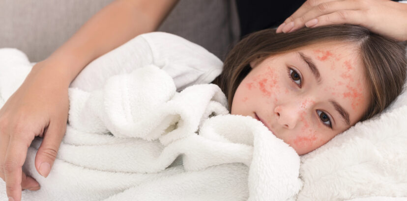 South Carolina Measles Outbreak Spreads To North Carolina And Beyond ...
